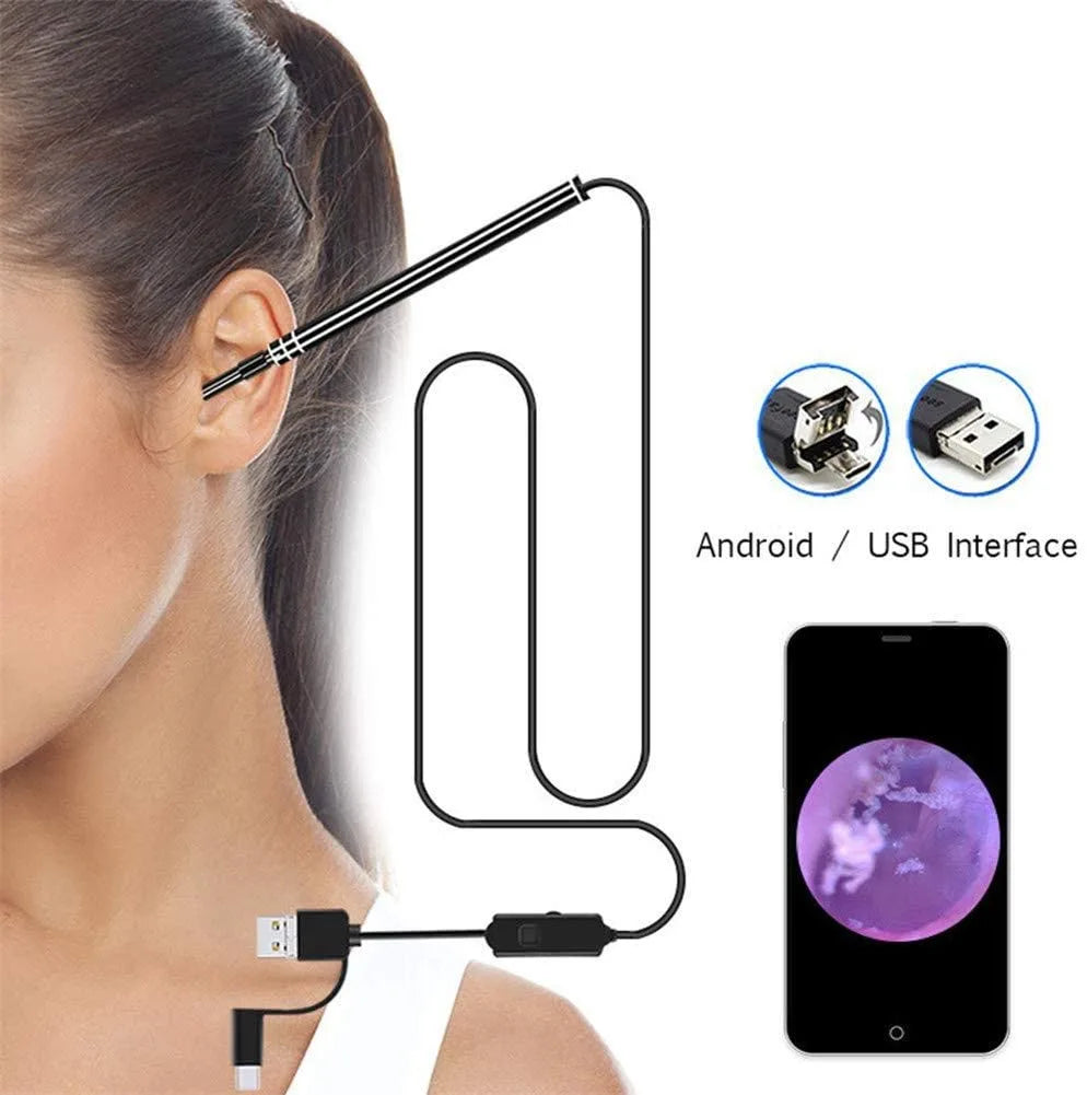 Audivix Ear Endoscope - Professional Inspection Tool - Visual Camera ...